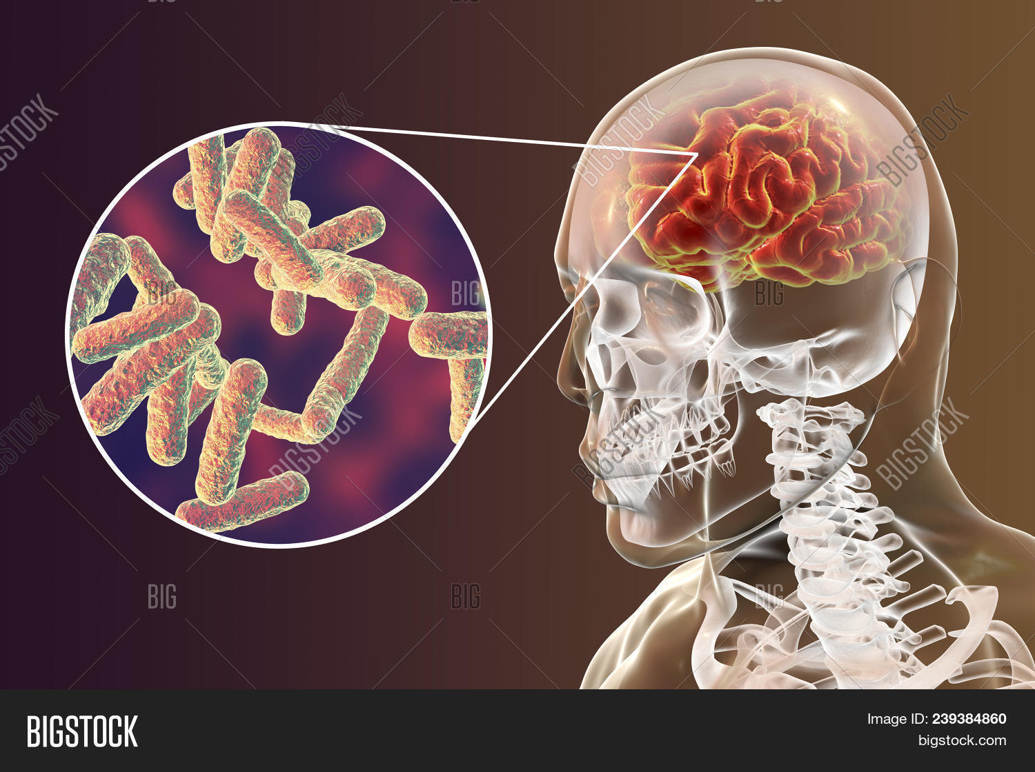 Bacterial Brain Image & Photo (Free Trial) | Bigstock