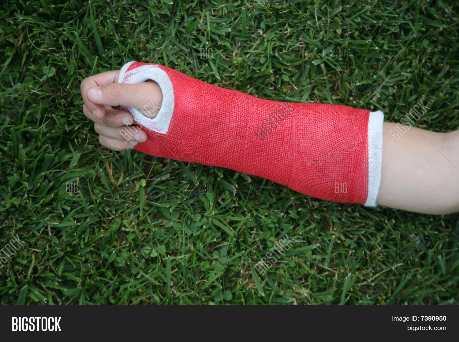 Red Wrist Arm Hand Image & Photo (Free Trial) | Bigstock