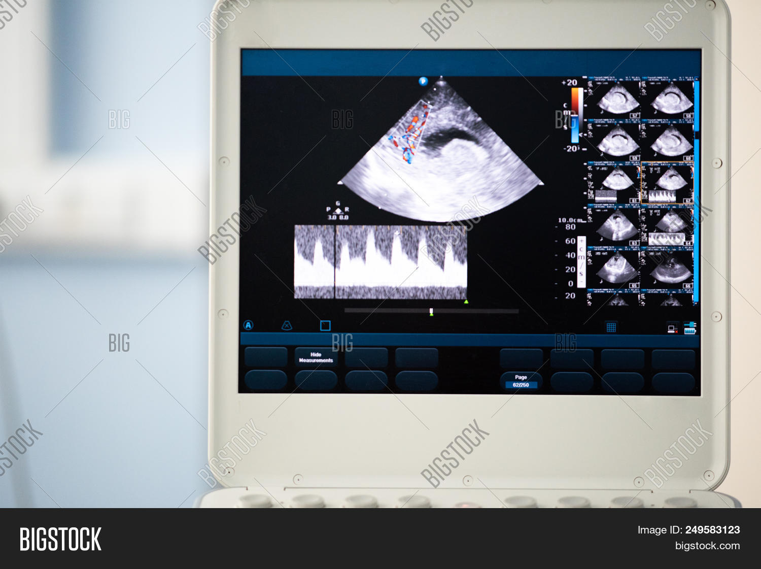 On Screen Ultrasound Image & Photo (Free Trial) | Bigstock