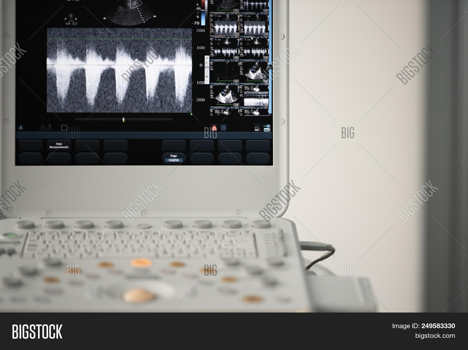 On Screen Ultrasound Image & Photo (Free Trial) | Bigstock