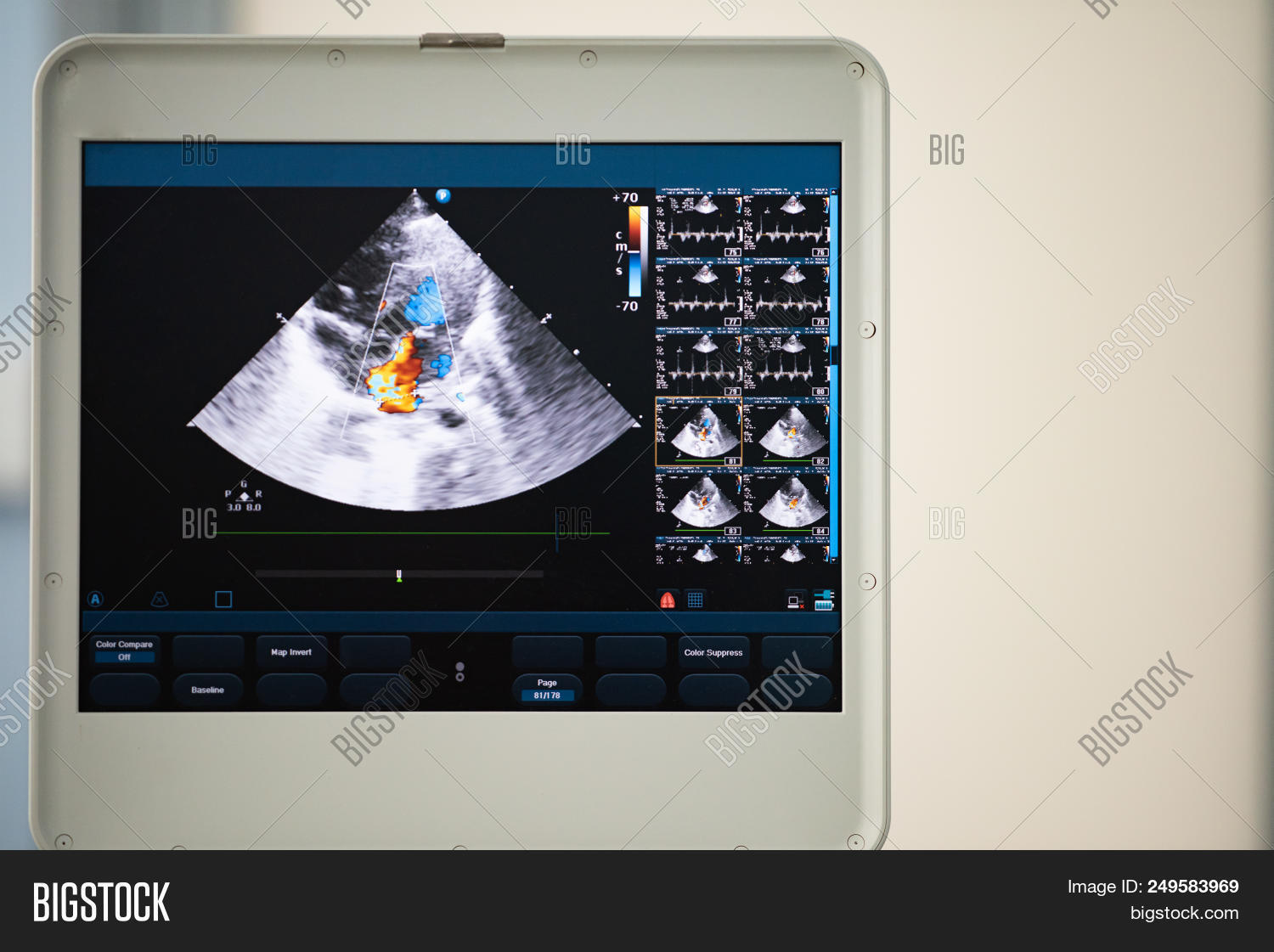 On Screen Ultrasound Image & Photo (Free Trial) | Bigstock