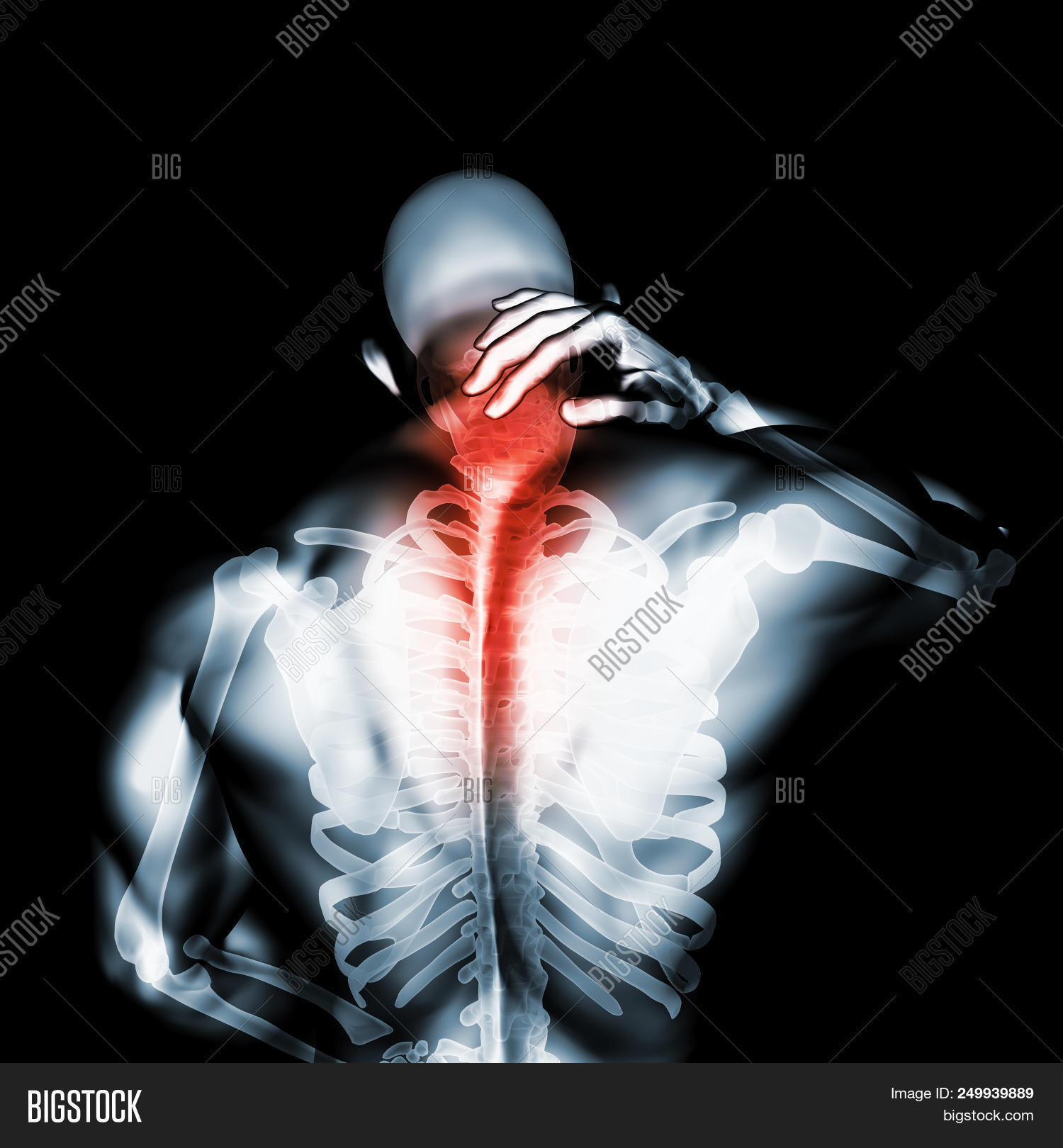 3d Illustration, Neck Image & Photo (Free Trial) | Bigstock