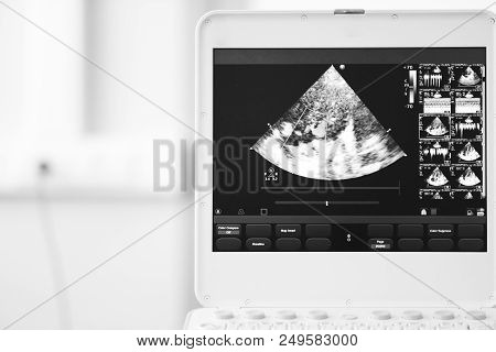 On Ultrasound Screen, Image & Photo (Free Trial) | Bigstock