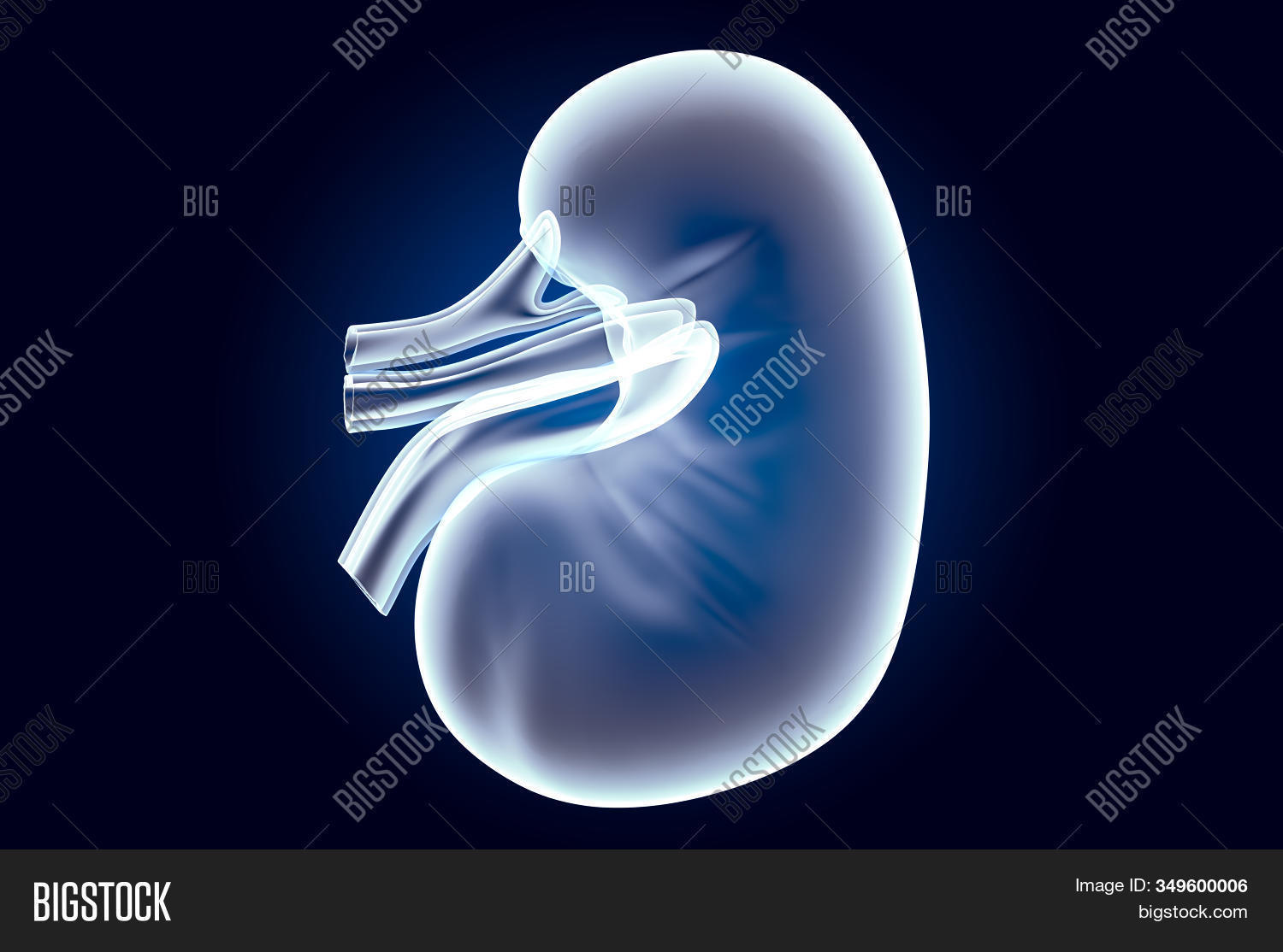 Human Kidney, X-ray Image & Photo (Free Trial) | Bigstock