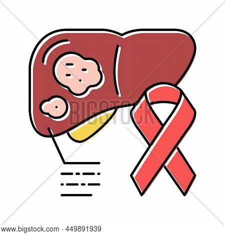Liver Cancer Color Vector & Photo (Free Trial) | Bigstock