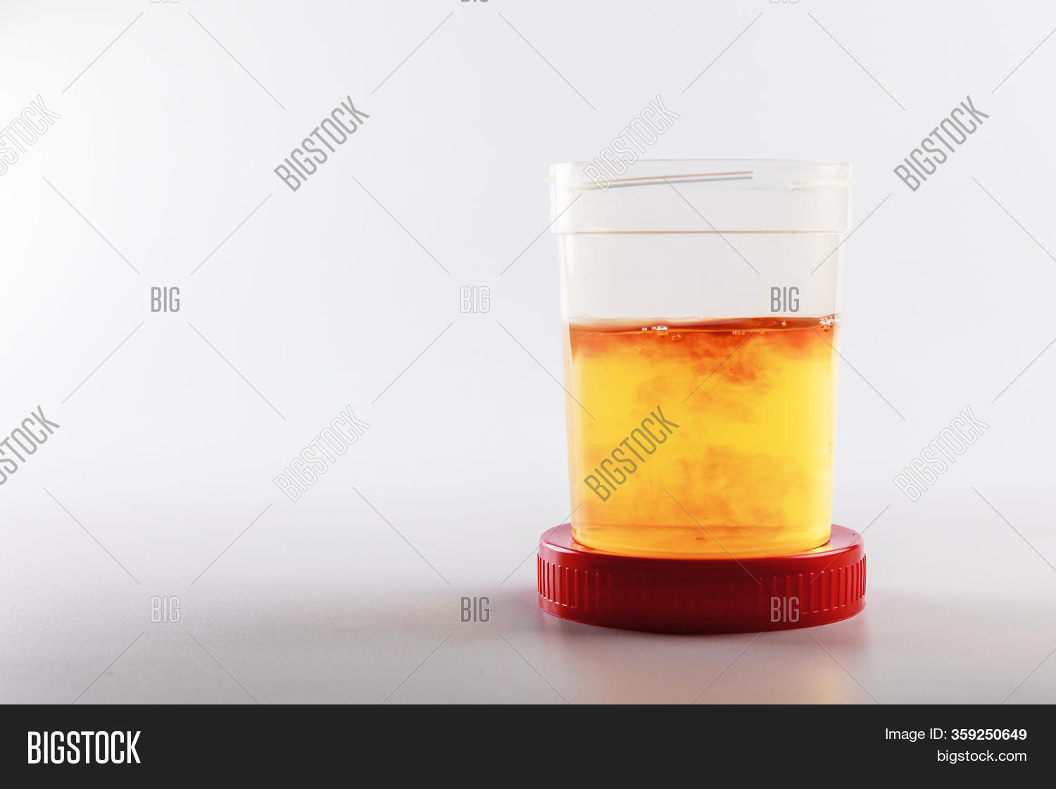 Blood Urine Analysis Image & Photo (Free Trial) | Bigstock