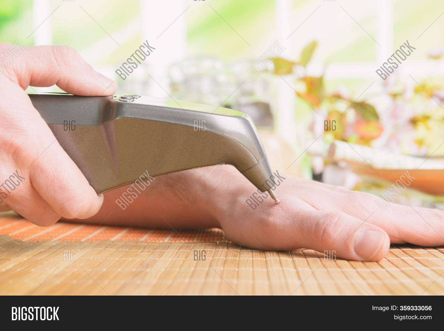 Finding Acupuncture Image & Photo (Free Trial) | Bigstock