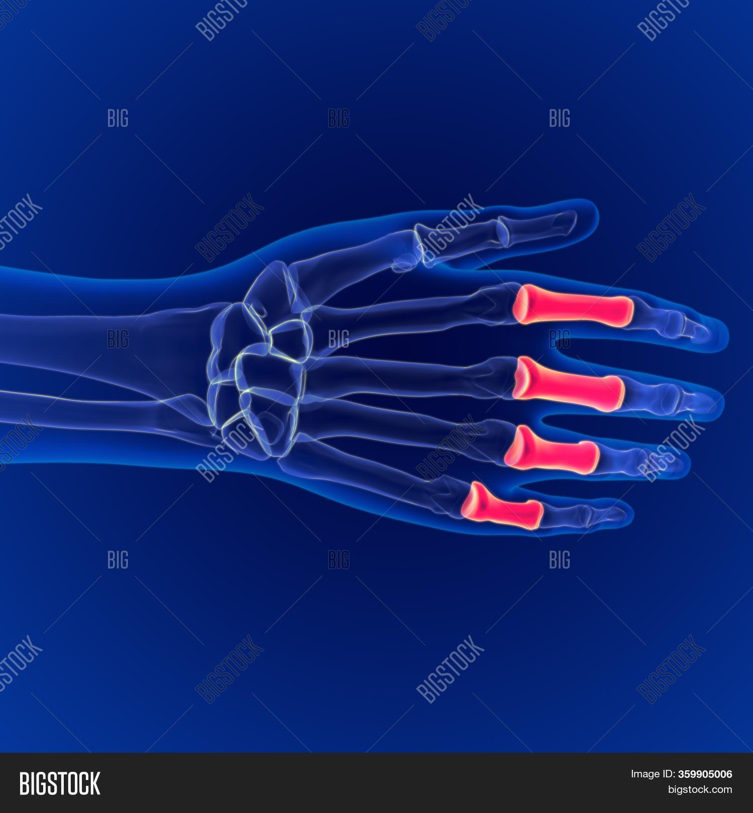 Human Skeleton Anatomy Image & Photo (Free Trial) | Bigstock