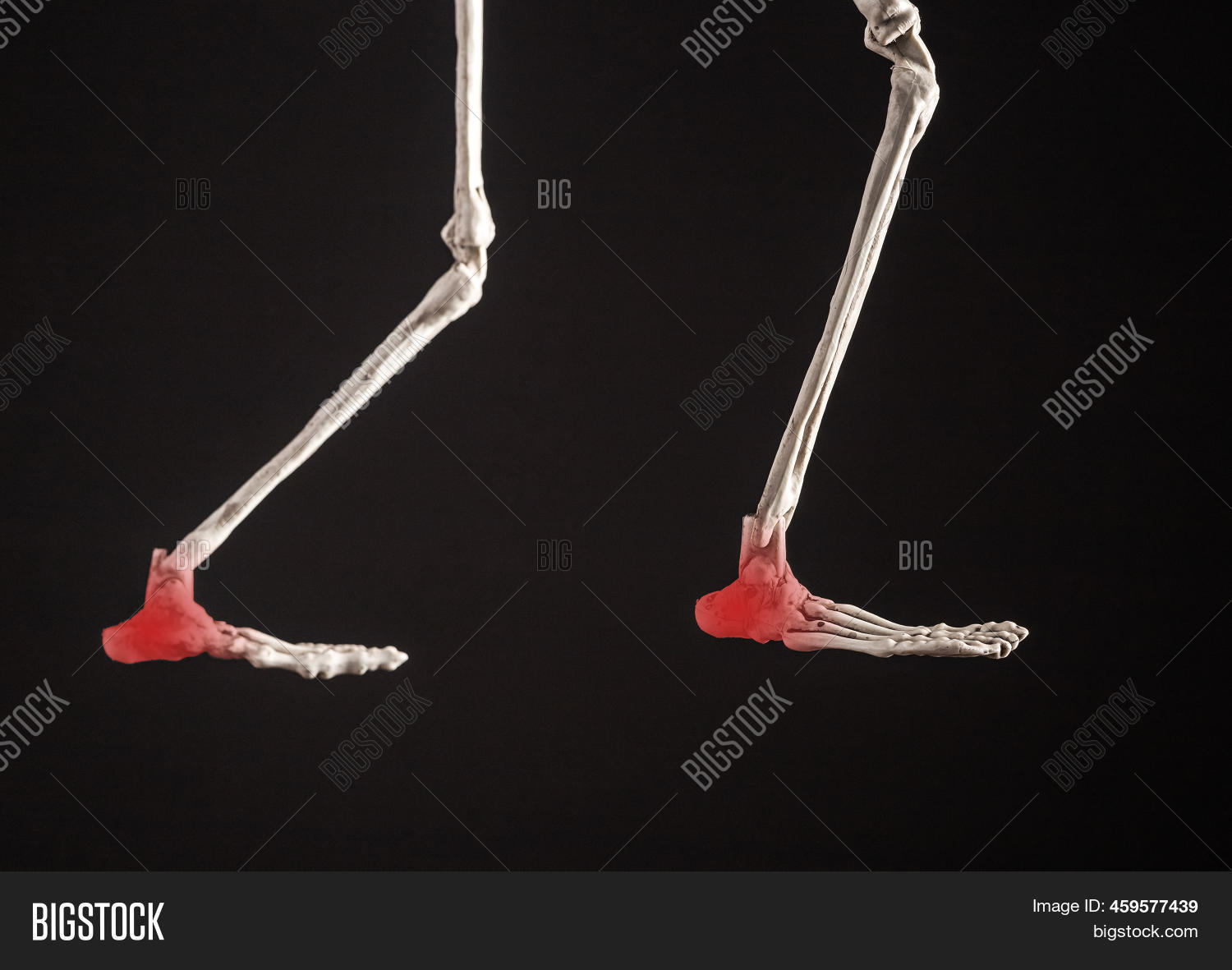 Human Skeleton Legs Image & Photo (Free Trial) | Bigstock