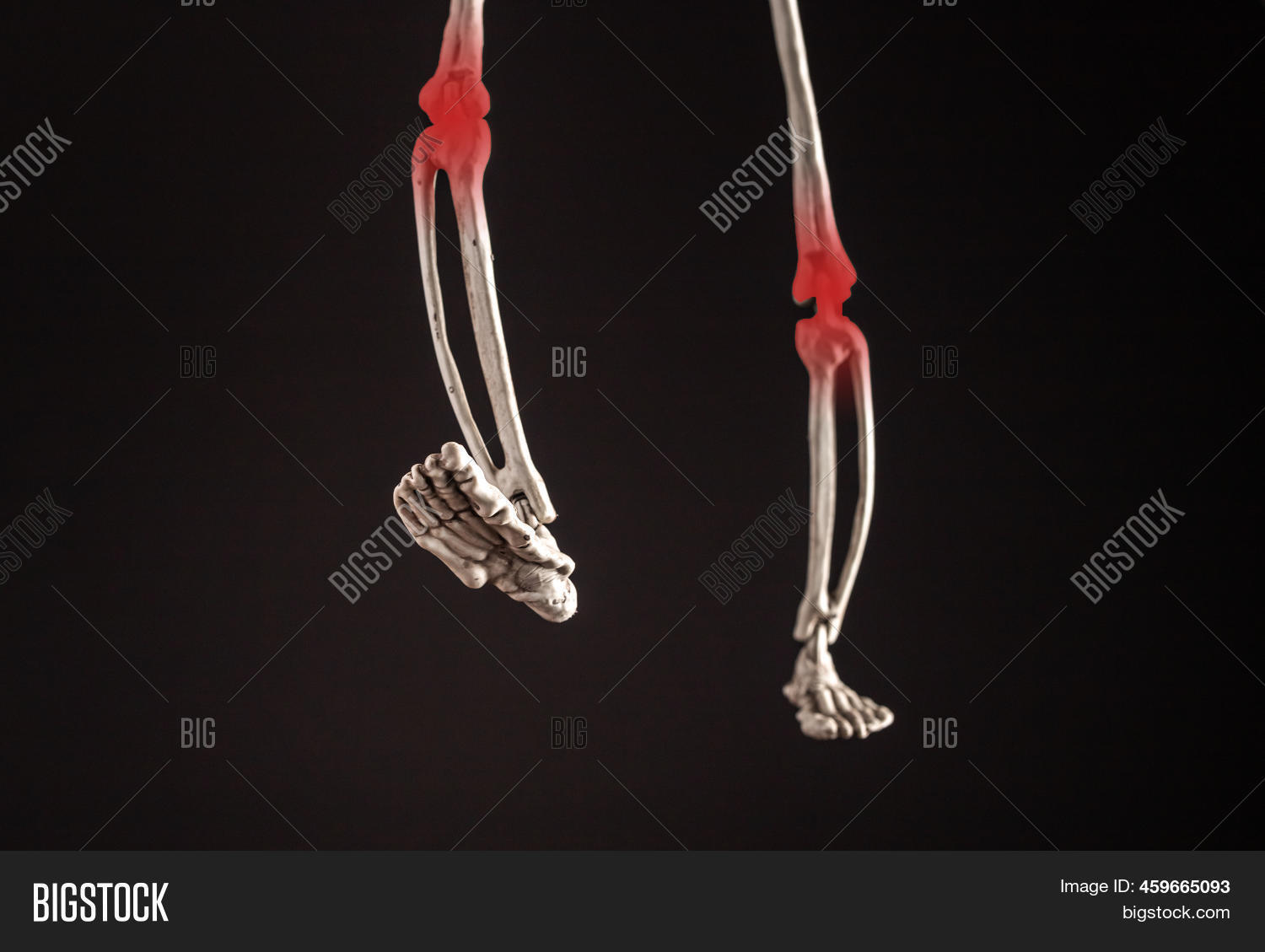 Human Skeleton Legs Image & Photo (Free Trial) | Bigstock