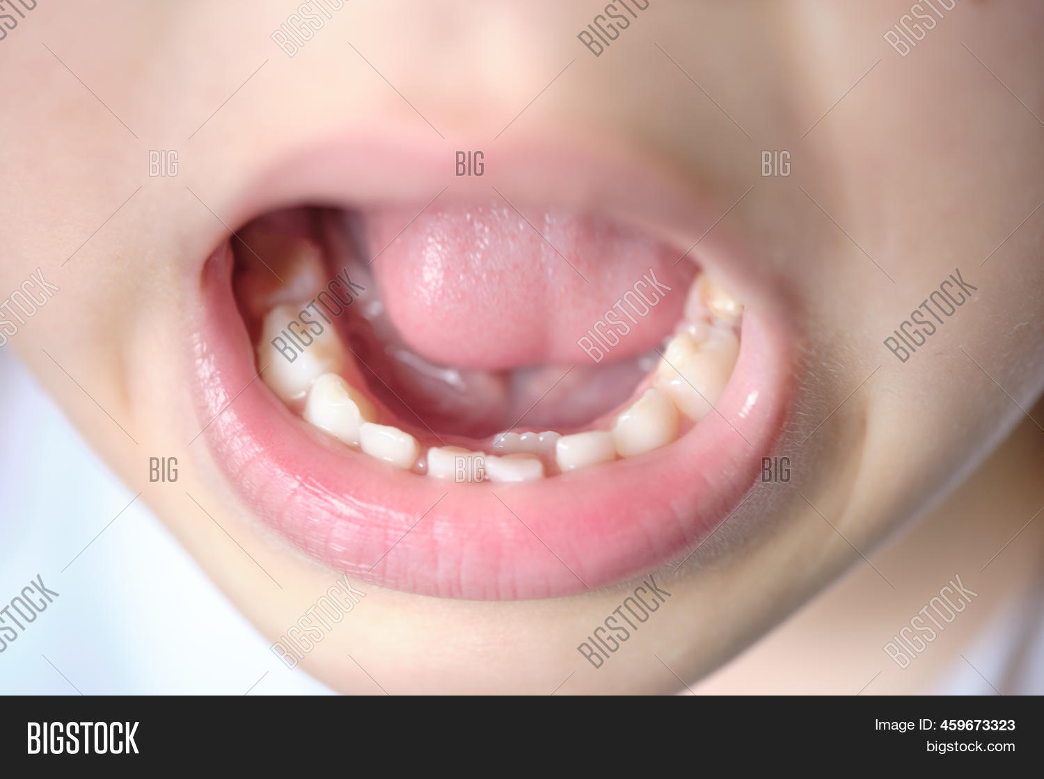 Open Mouth Child Milk Image & Photo (Free Trial) | Bigstock