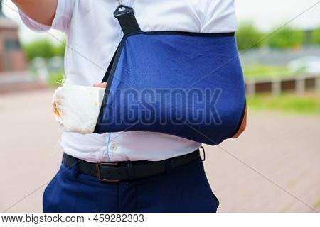 Man Broken Arm Cast. Image & Photo (Free Trial) | Bigstock