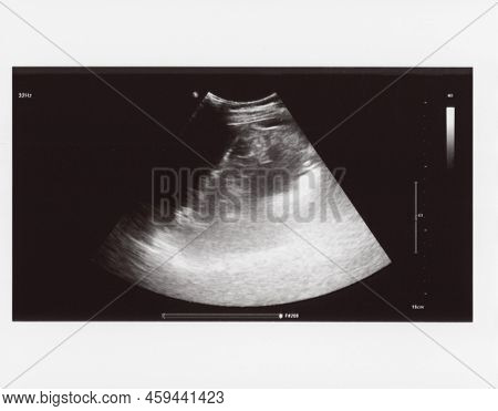 Full Abdomen Image & Photo (Free Trial) | Bigstock