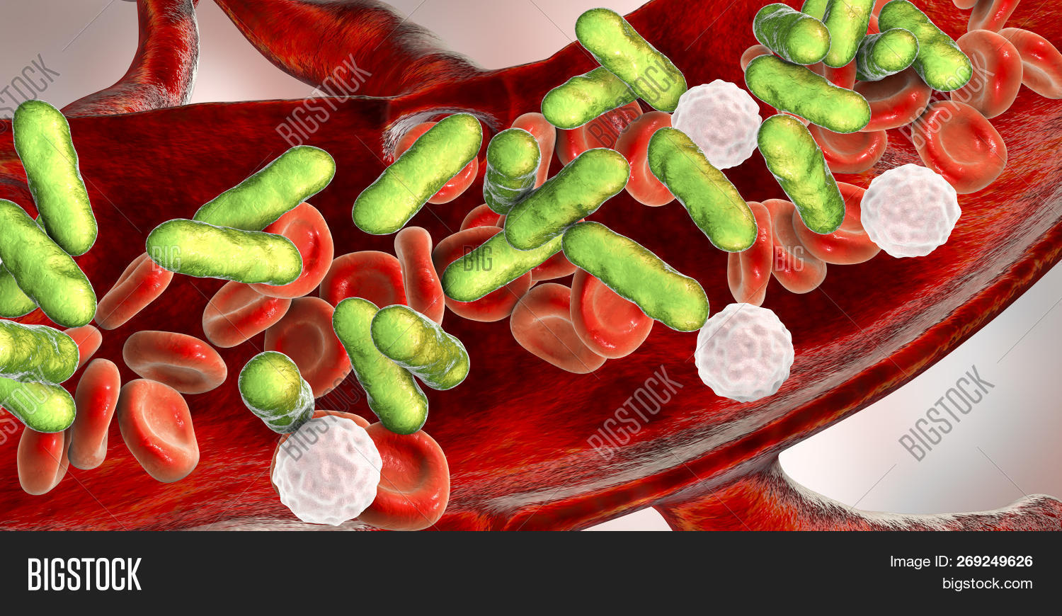 Sepsis, Bacteria Blood Image & Photo (Free Trial) | Bigstock