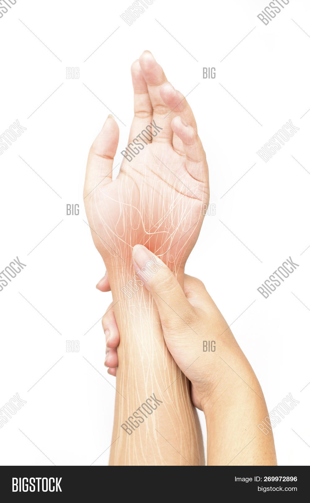 Wrist Bones Injury Image & Photo (Free Trial) | Bigstock