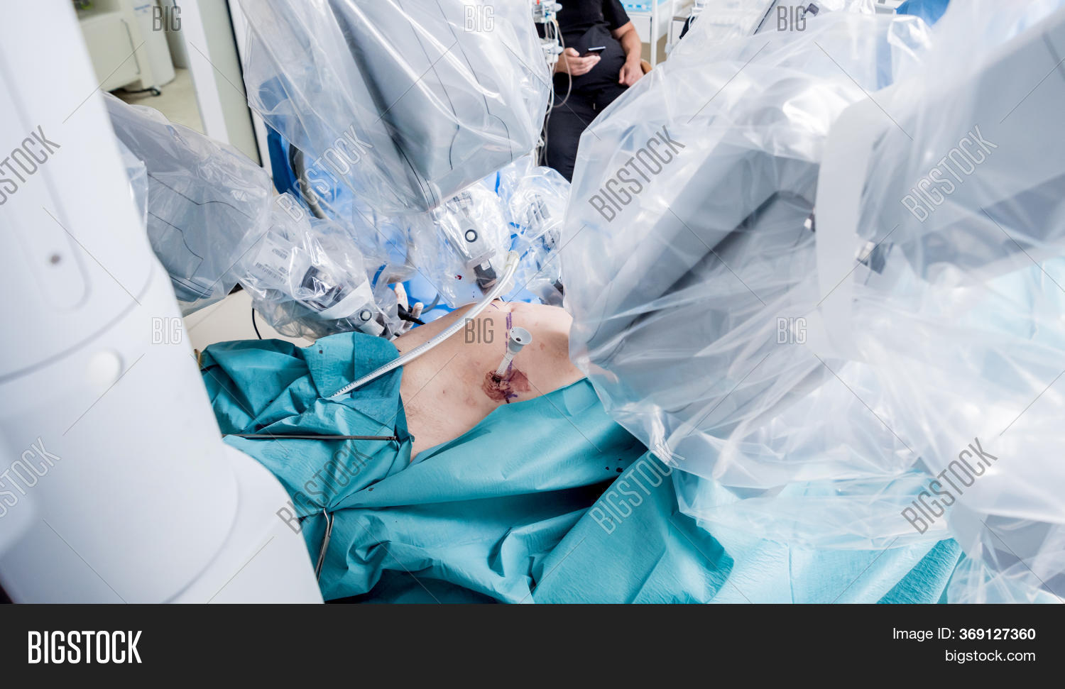 Modern Surgical System Image & Photo (Free Trial) | Bigstock