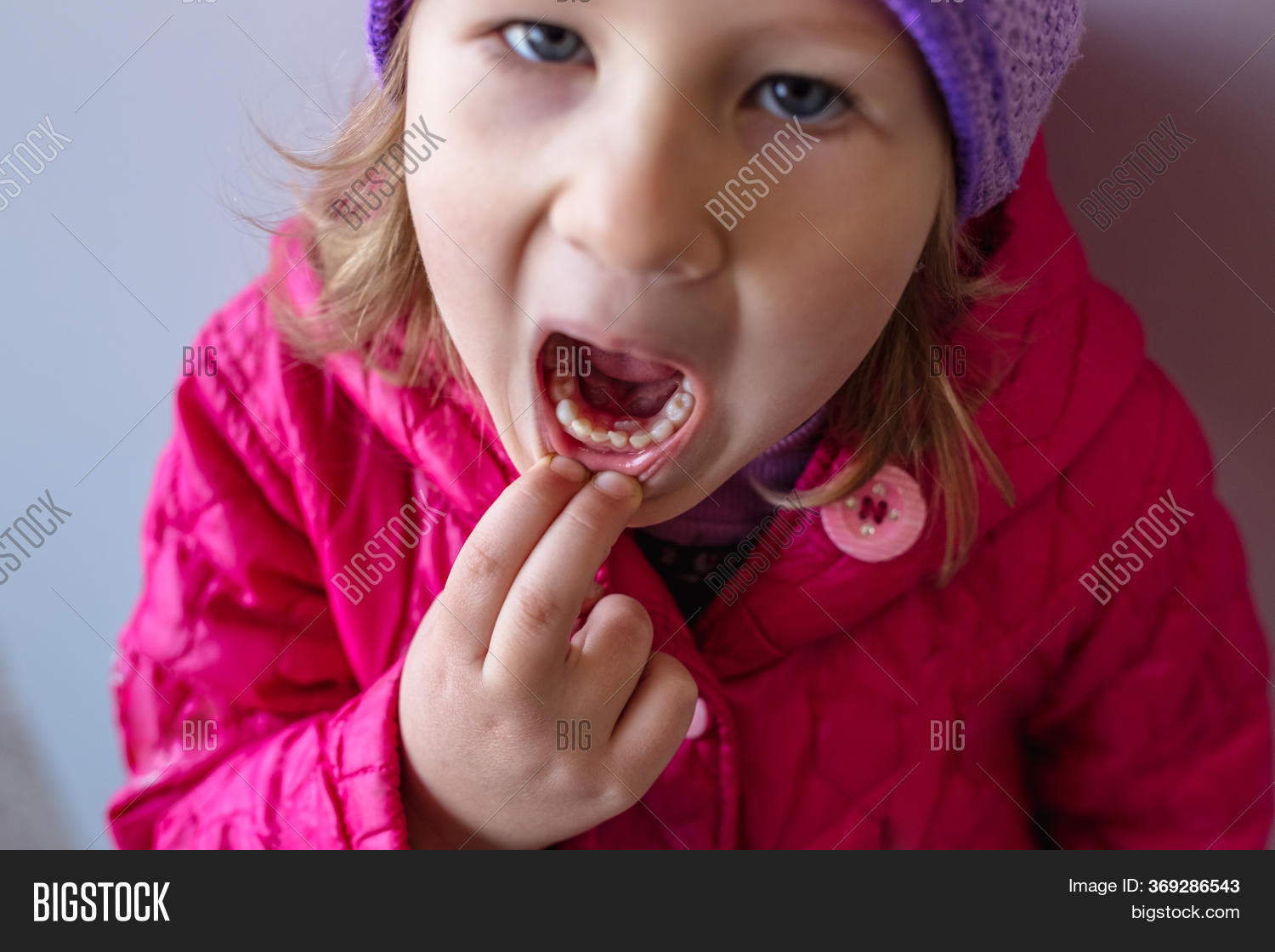 Adult Permanent Teeth Image & Photo (Free Trial) | Bigstock