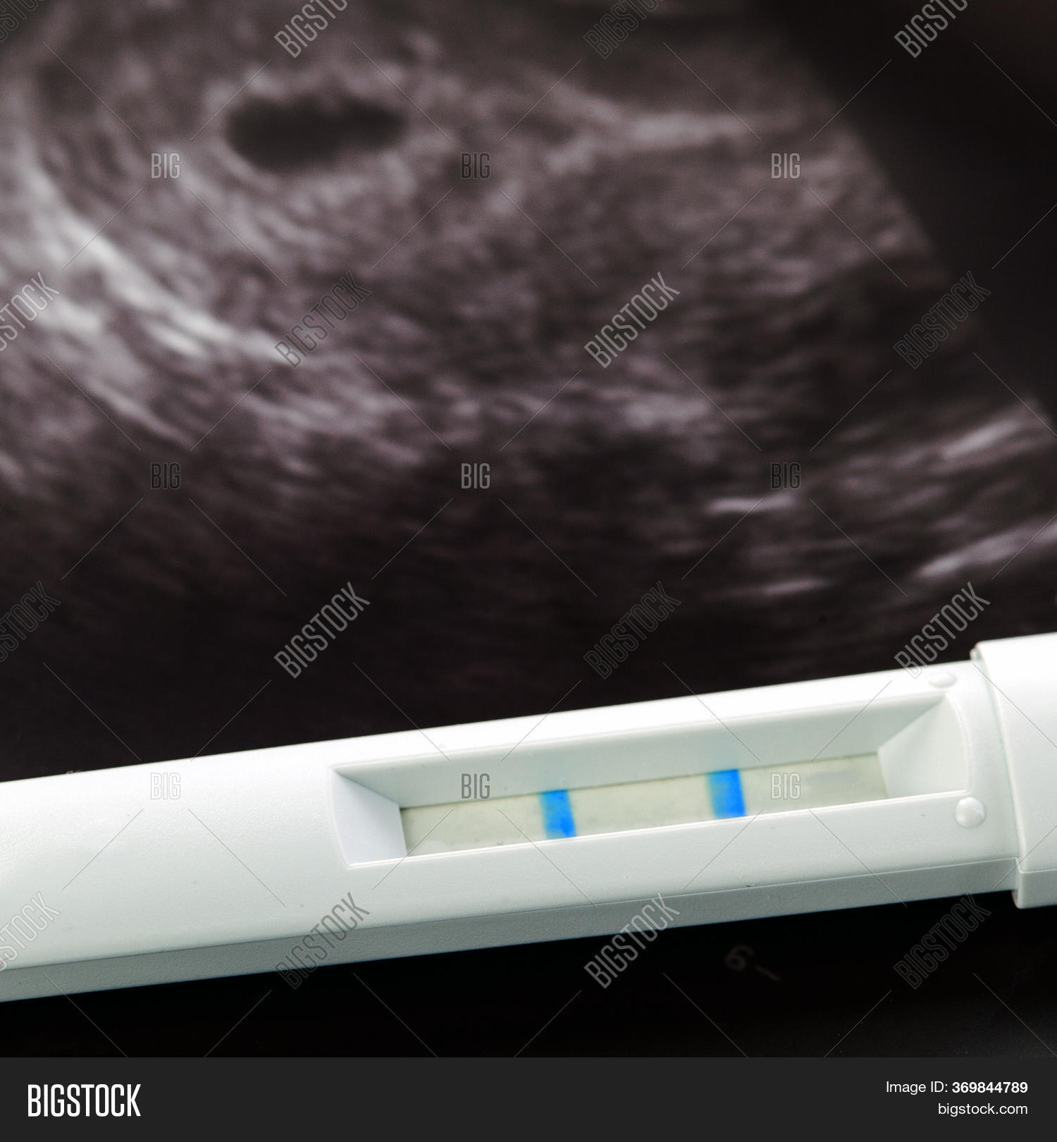 Positive Pregnancy Image & Photo (Free Trial) | Bigstock