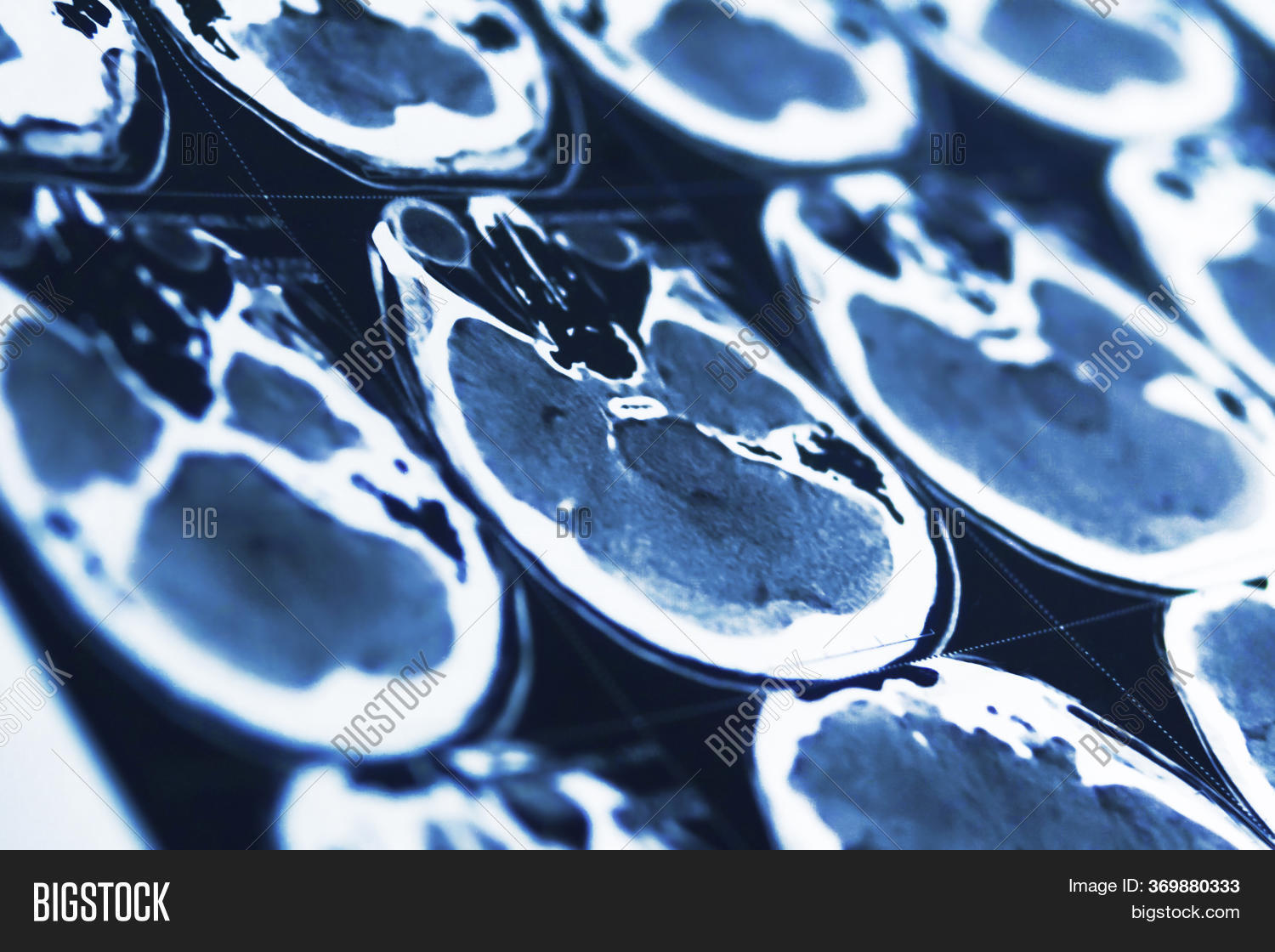 Blurred Closeup Brain Image & Photo (Free Trial) | Bigstock
