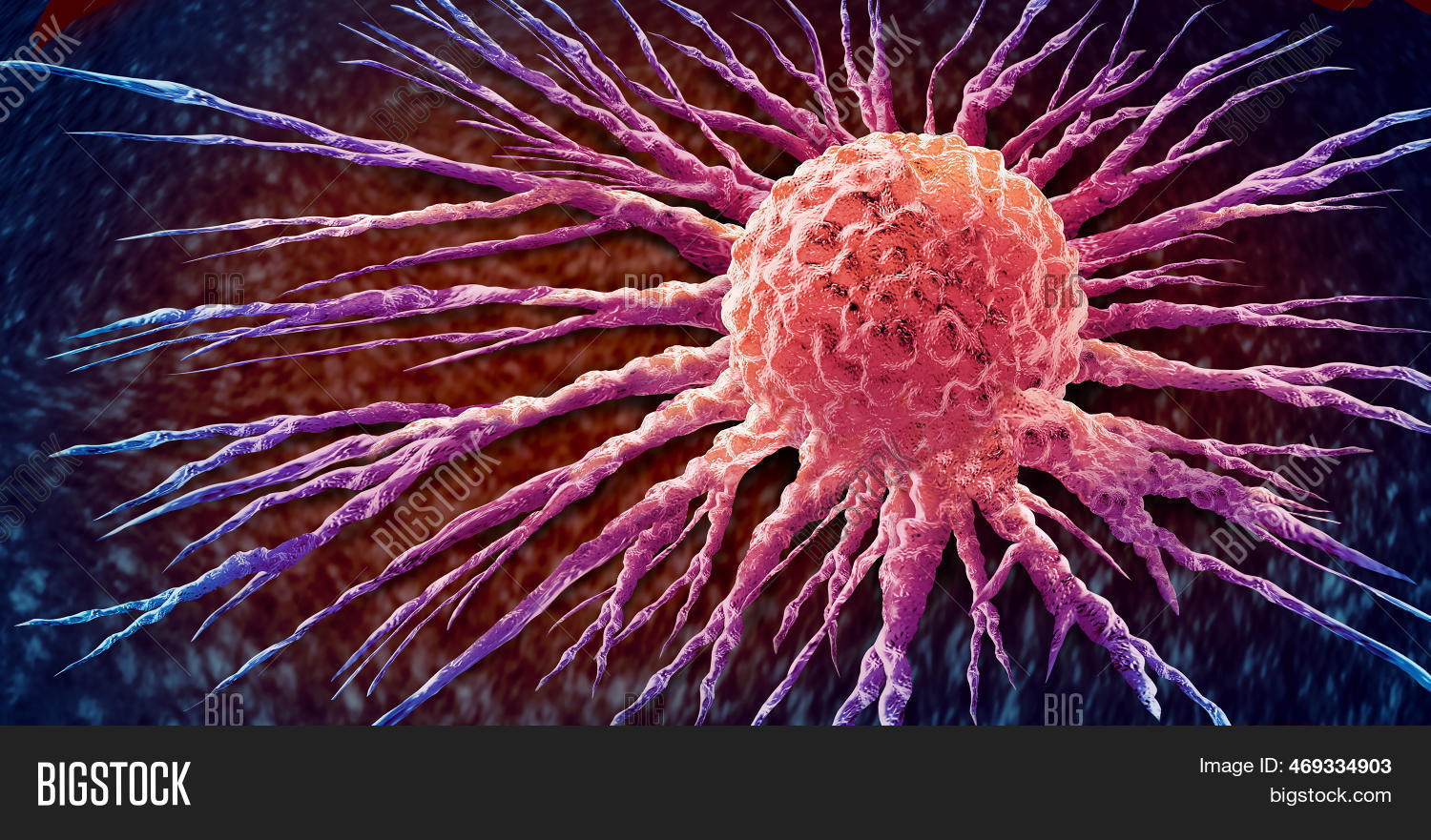 Cancer Cell Spread Image & Photo (Free Trial) | Bigstock