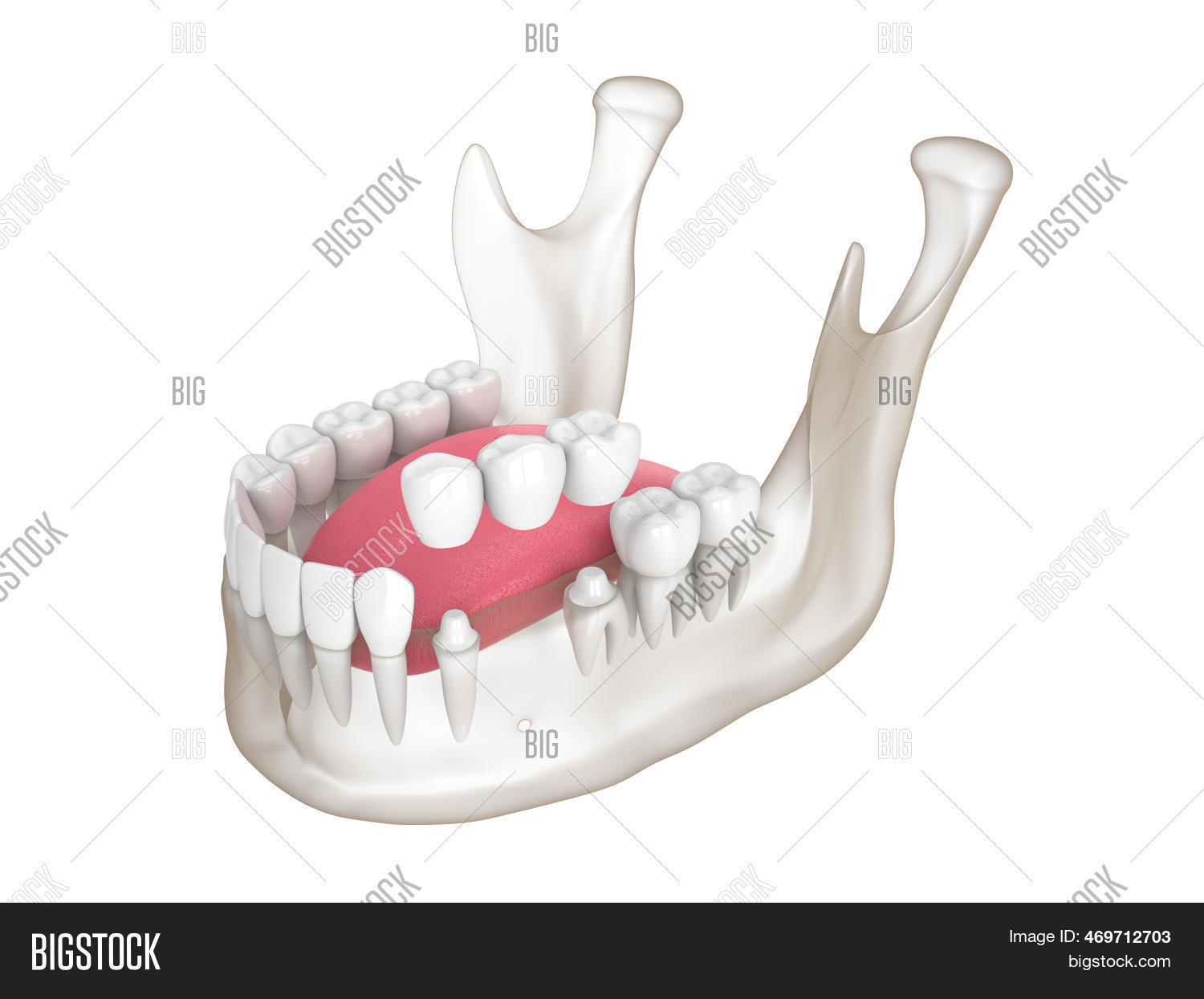3d Render Mandible Image & Photo (Free Trial) | Bigstock