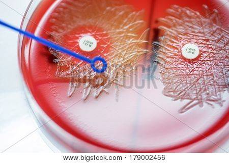 Optochin Image & Photo (Free Trial) | Bigstock