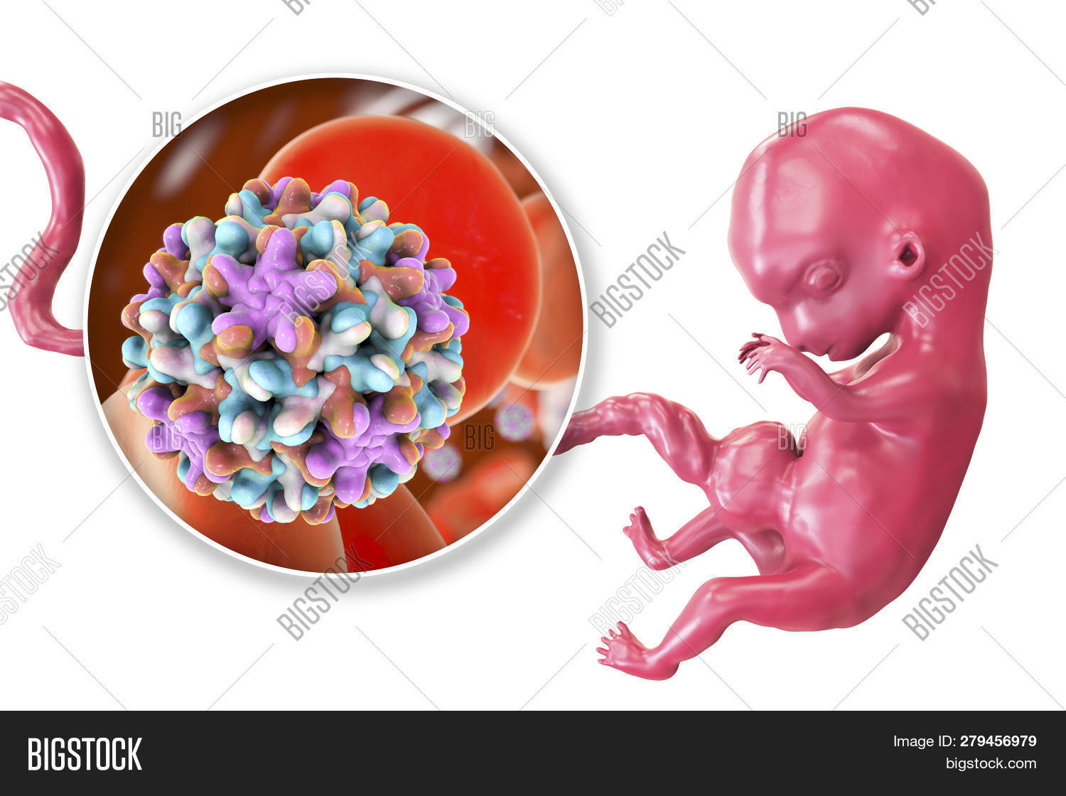 Transplacental Image & Photo (Free Trial) | Bigstock