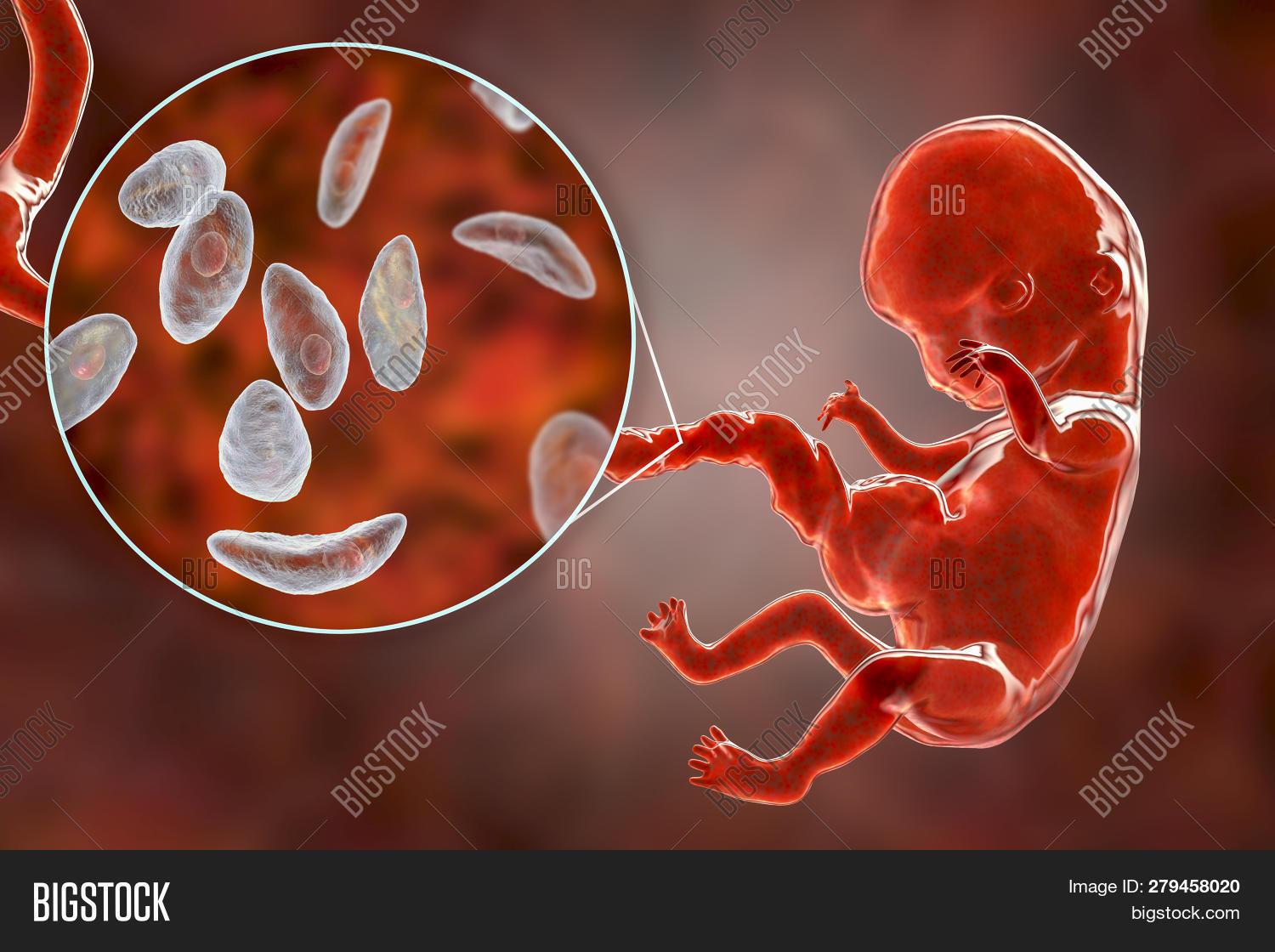 Transplacental Image & Photo (Free Trial) | Bigstock