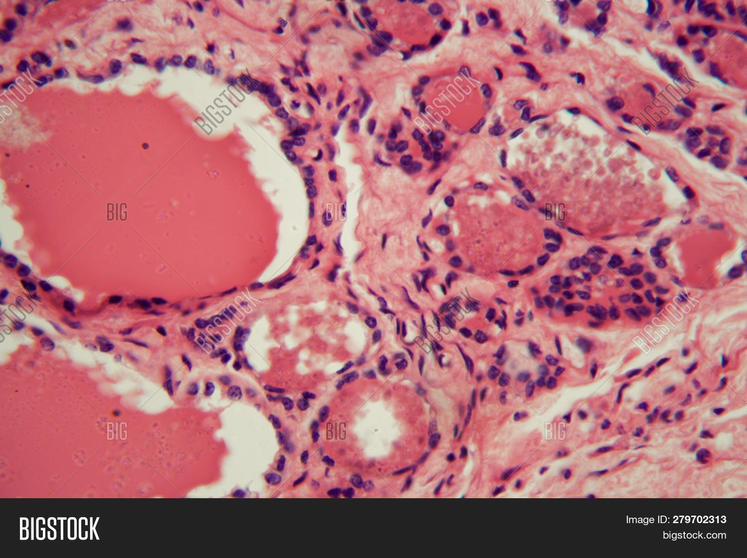 Cells Human Thyroid Image & Photo (Free Trial) | Bigstock