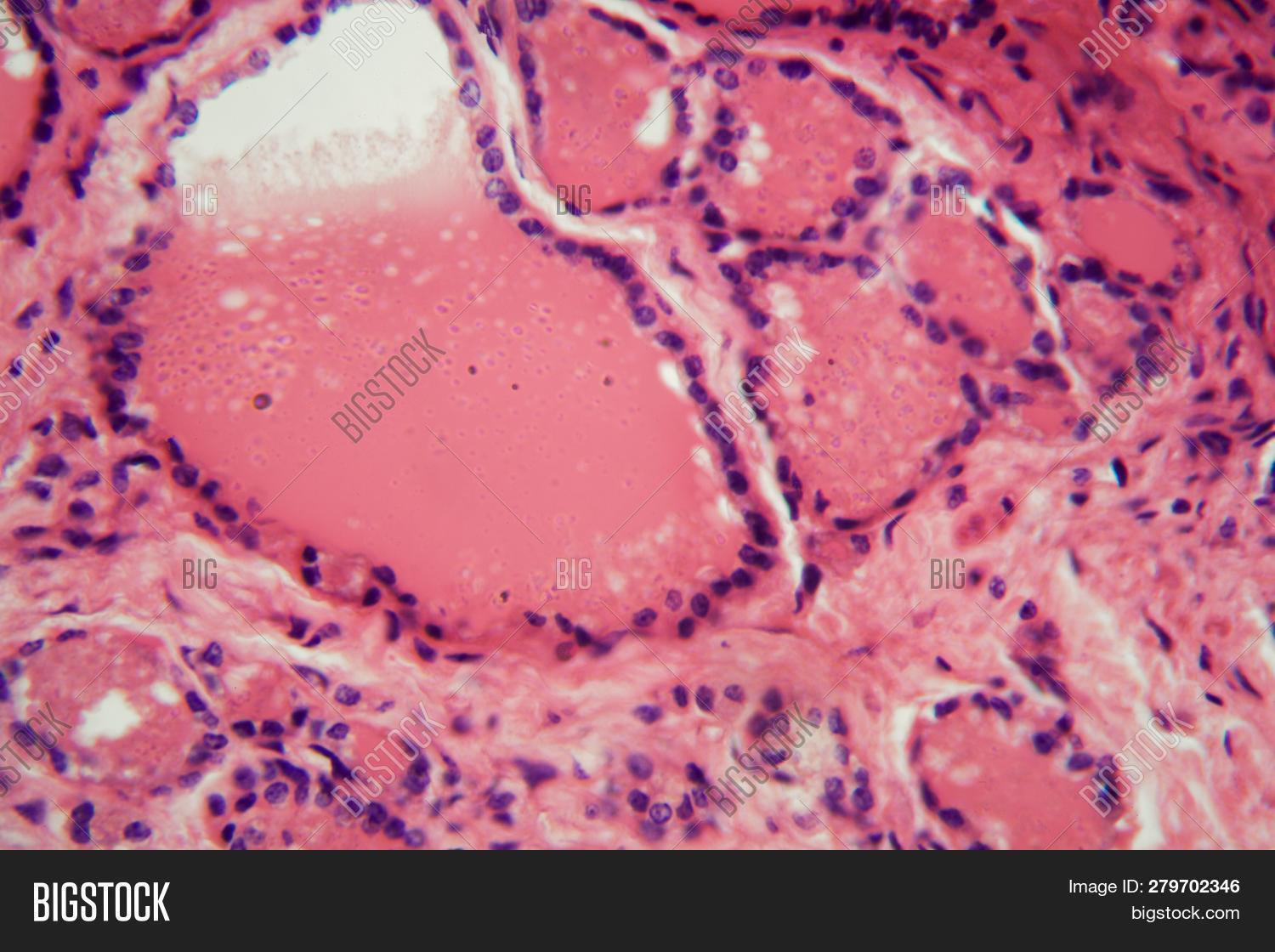 Cells Human Thyroid Image & Photo (Free Trial) | Bigstock