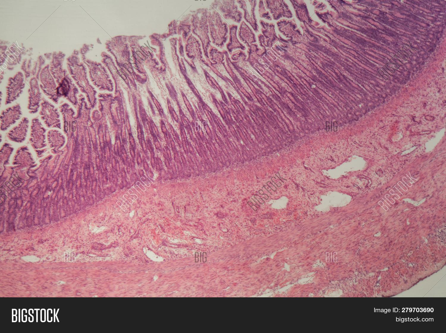 Microscope Photo Large Image & Photo (Free Trial) | Bigstock