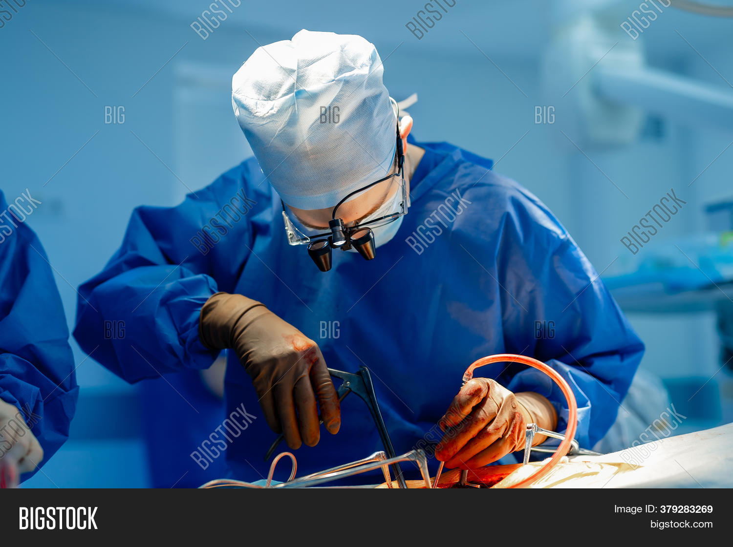 Surgery Operation. Image & Photo (Free Trial) | Bigstock