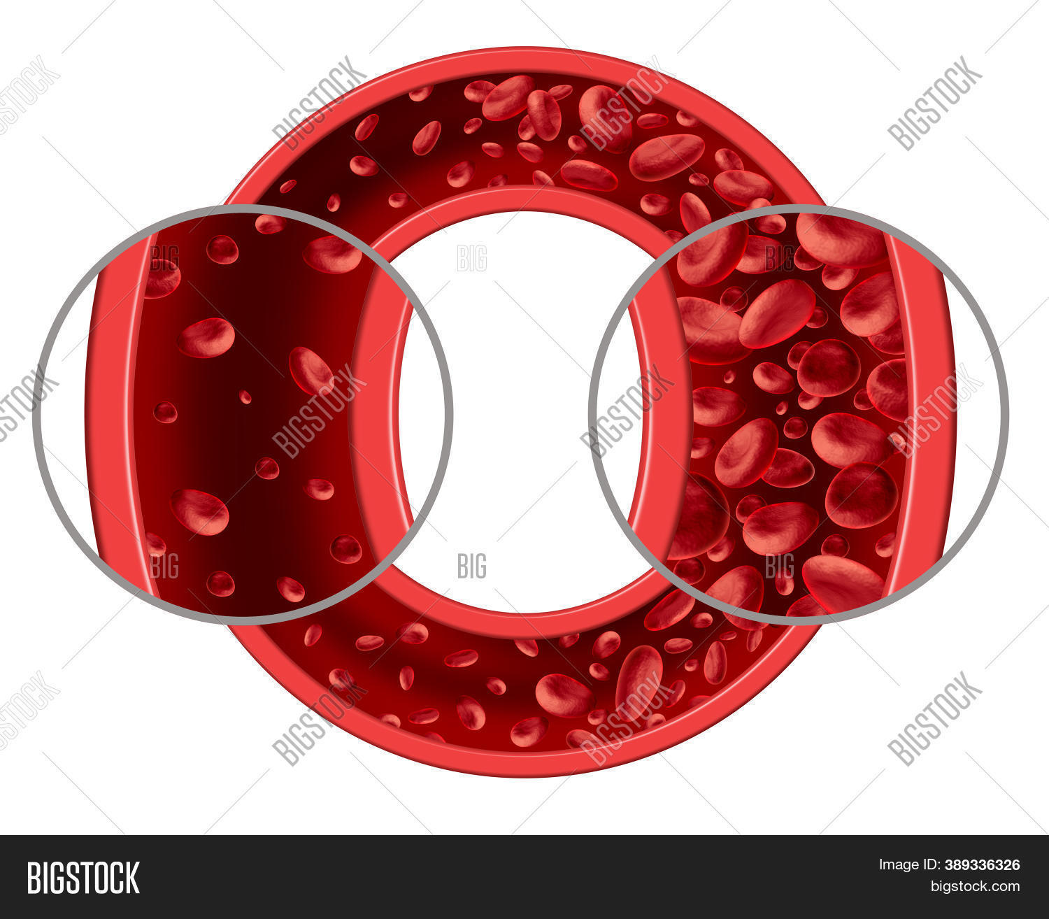 Abnormal Red Blood Cell Chart