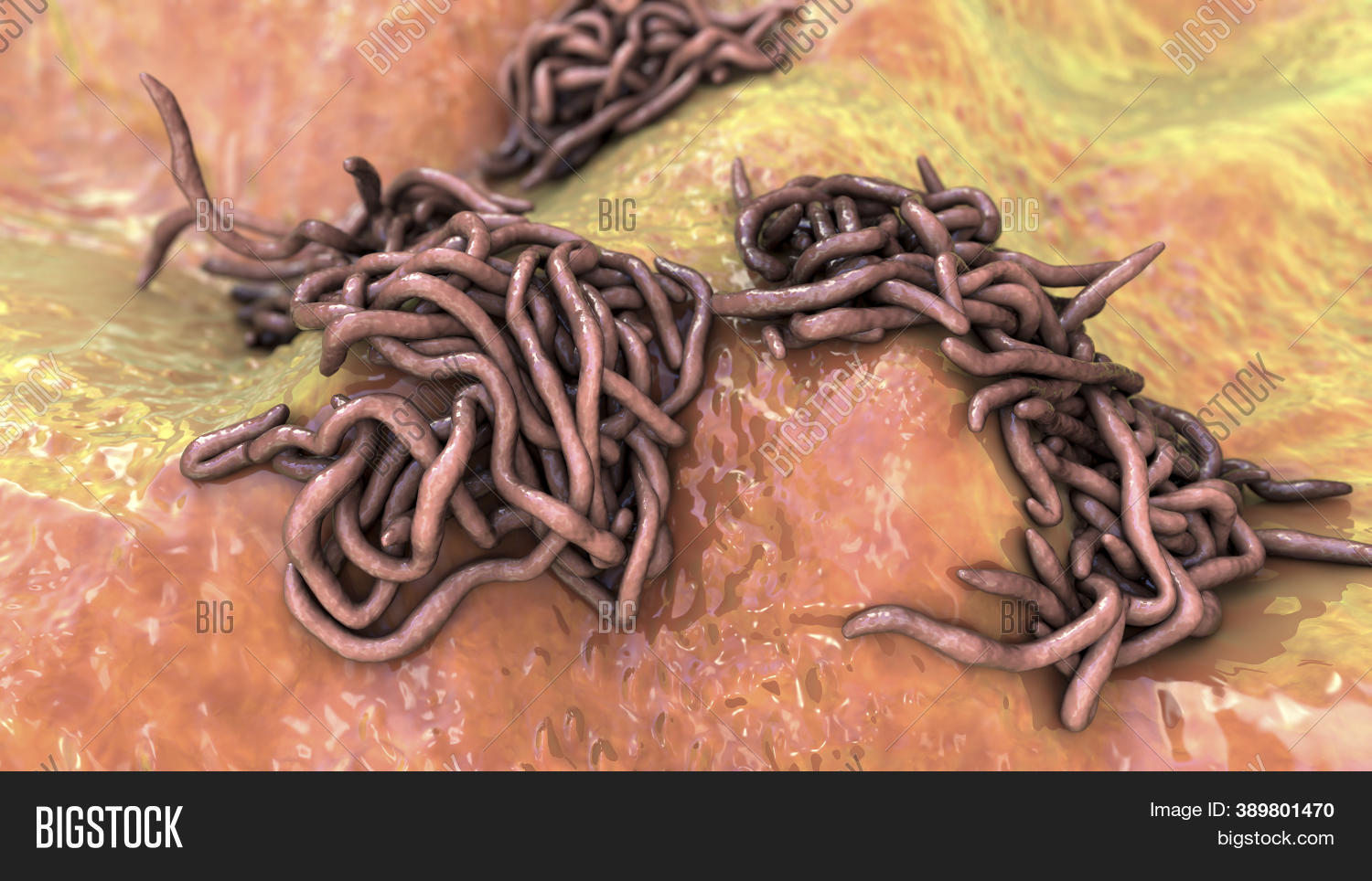 Parasitic Worms, 3d Image & Photo (Free Trial) | Bigstock