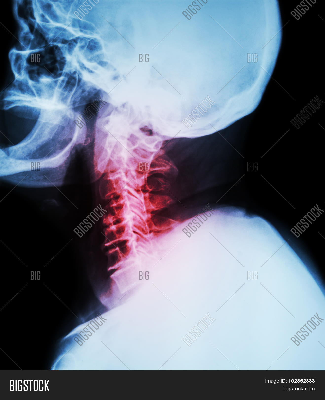 cervical-千图网