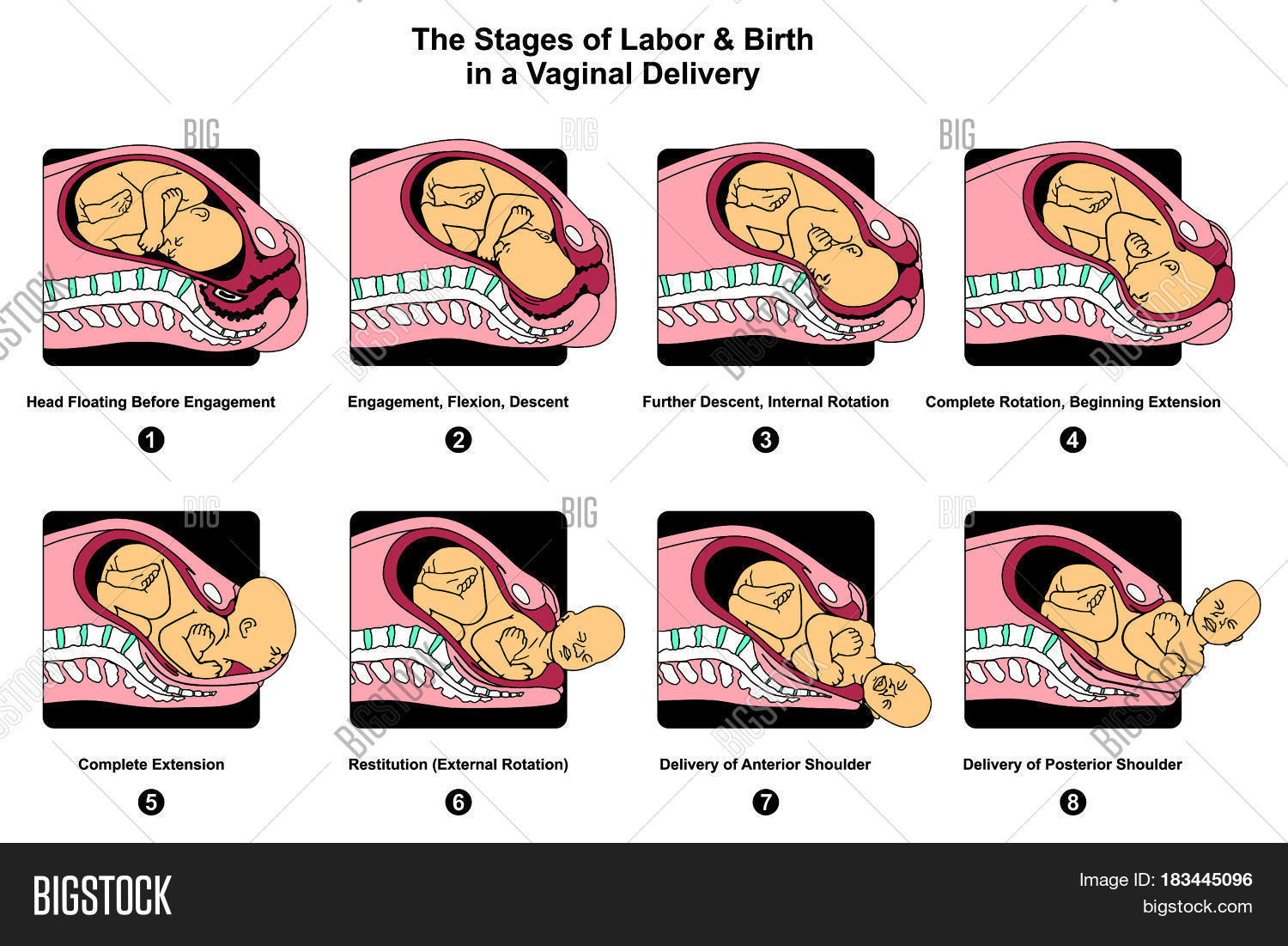 Stages Labor Birth Vaginal Delivery Image & Photo | Bigstock