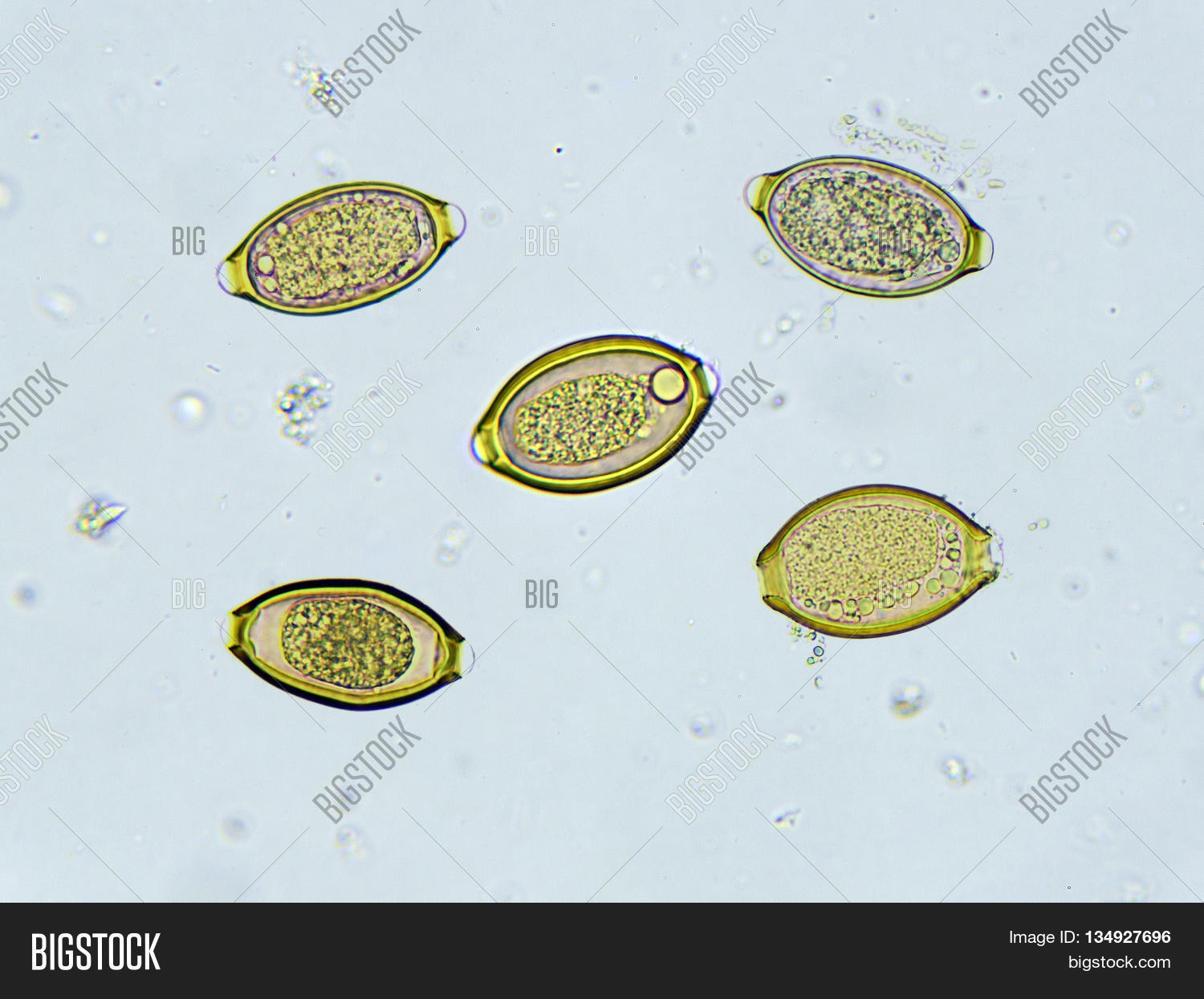Egg of Trichuris trichiura in stool, analyze by microscope Stock Photo ...