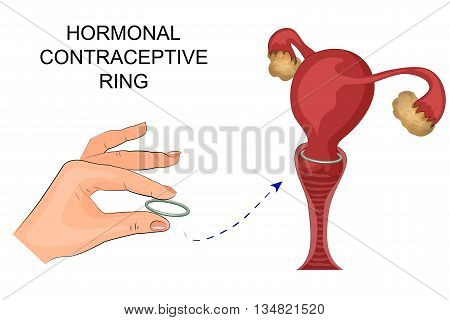 Womb Images, Stock Photos & Illustrations | Bigstock
